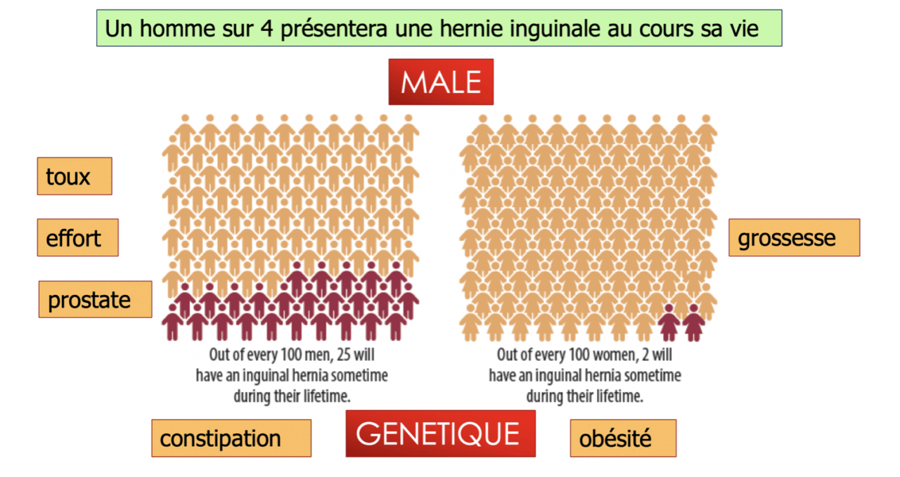 Qu'est-ce que c'est la hernie inguinale ? - Dr méd. Vincent Ott (FMH)